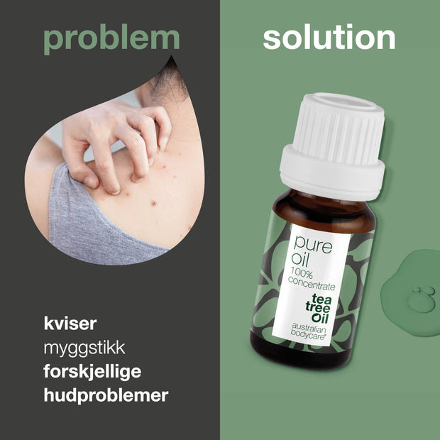 Byller må behandles – Les mer om hvordan